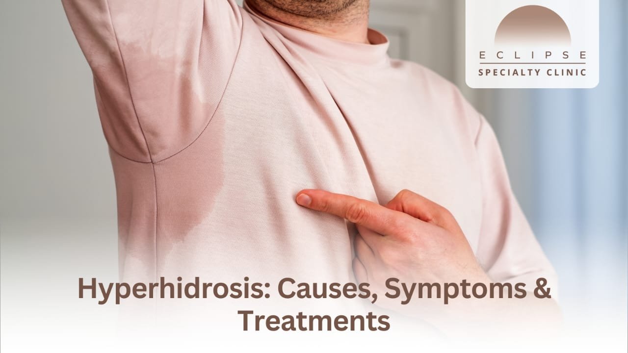 Hyperhidrosis Treatment in Dubai | Solution for Excessive Sweating